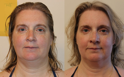 30 Days, 30 Pounds: The Aftermath – Astrid Cook – AUTHOR, SINGER, ARTIST